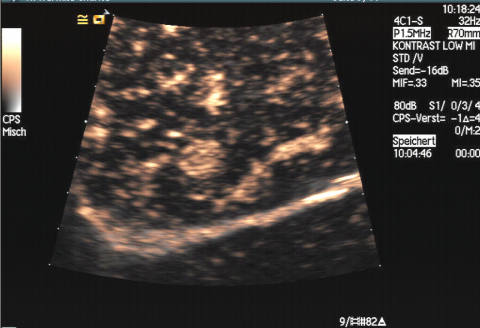 Ultraschall | Praxis Bauditz